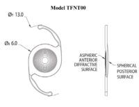 PanOptix Lens Review | A Complete Guide to the PanOptix IOL