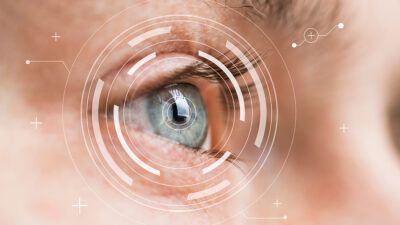 What Does Medicare Cover For Cataract Surgery? | For Patients